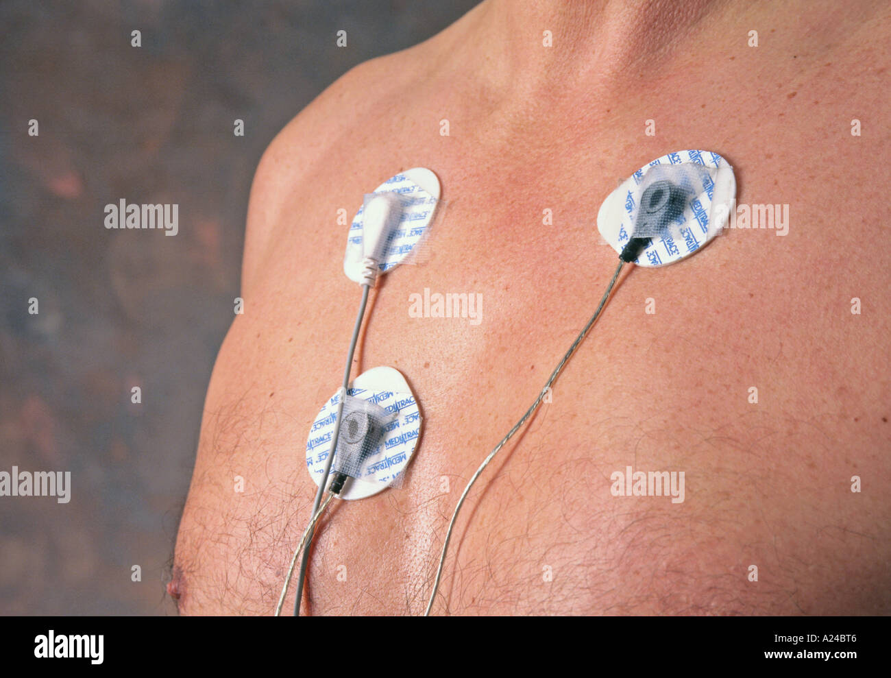 Man wearing portable EKG monitor Stock Photo - Alamy