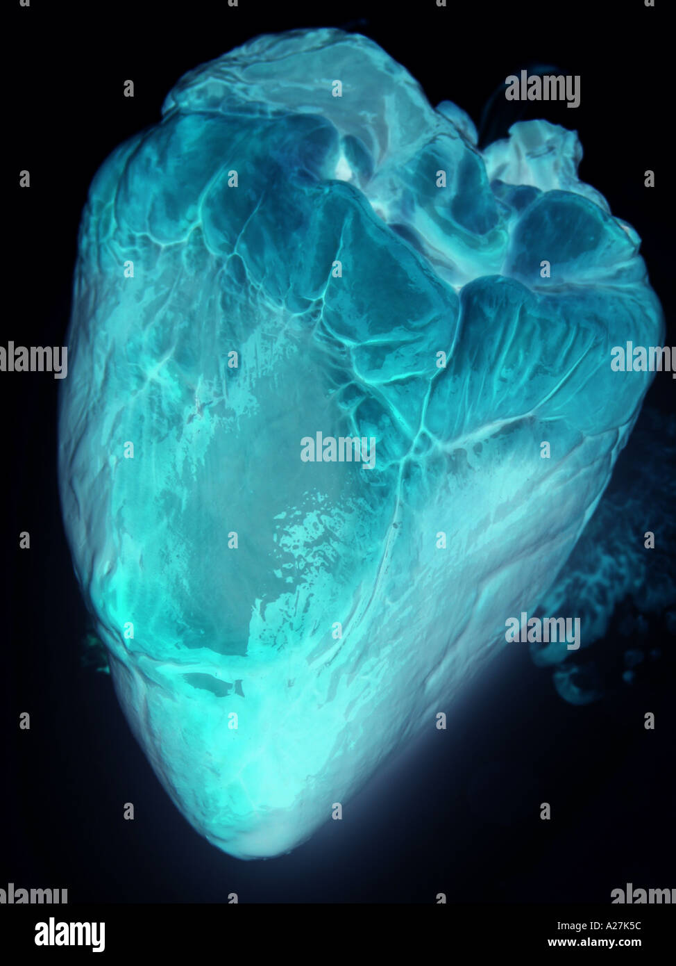 Heart blood vessels scan hi-res stock photography and images - Alamy