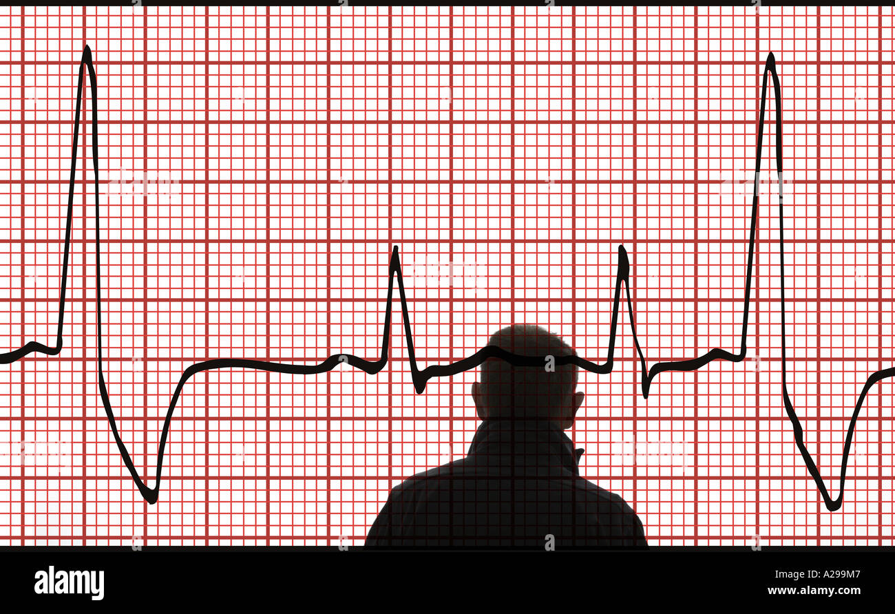 Ekg technician hi-res stock photography and images - Alamy