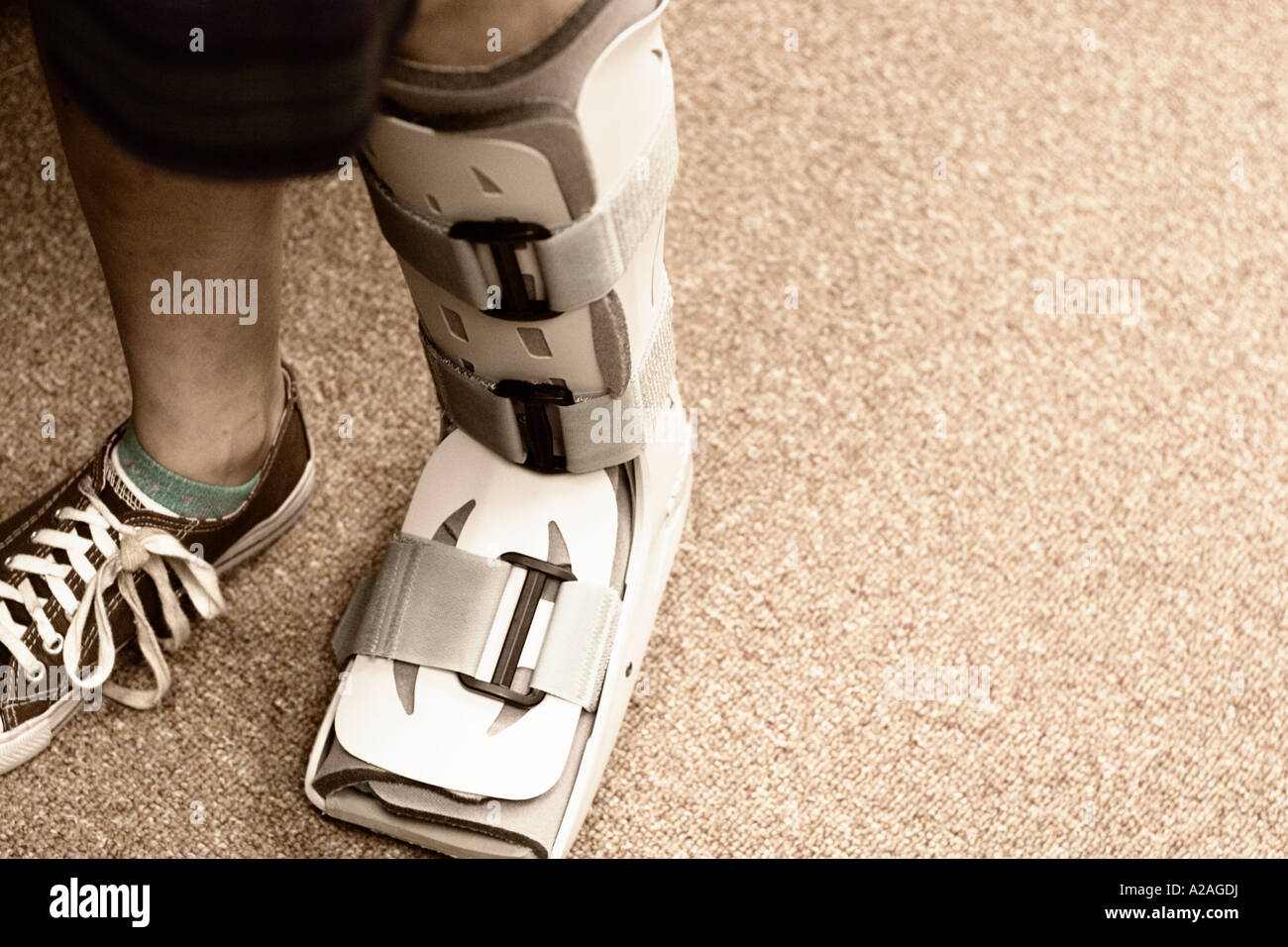 child foot in cast Stock Photo - Alamy