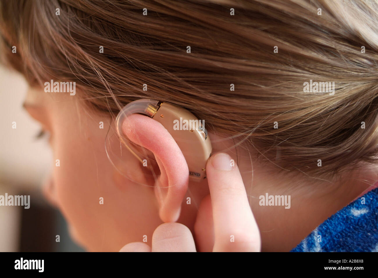 Child with hearing system Stock Photo - Alamy