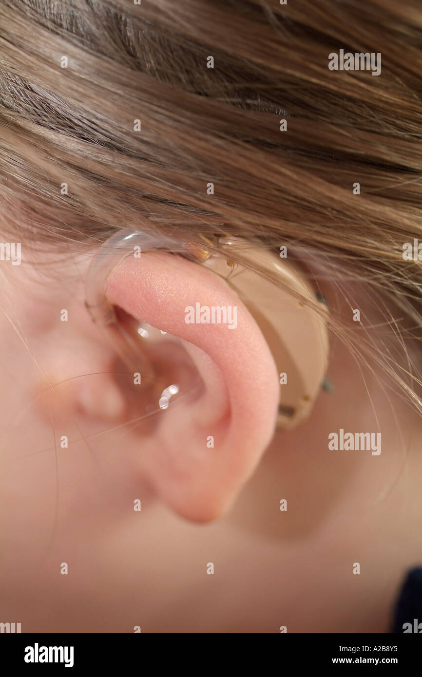 Child with hearing system Stock Photo - Alamy