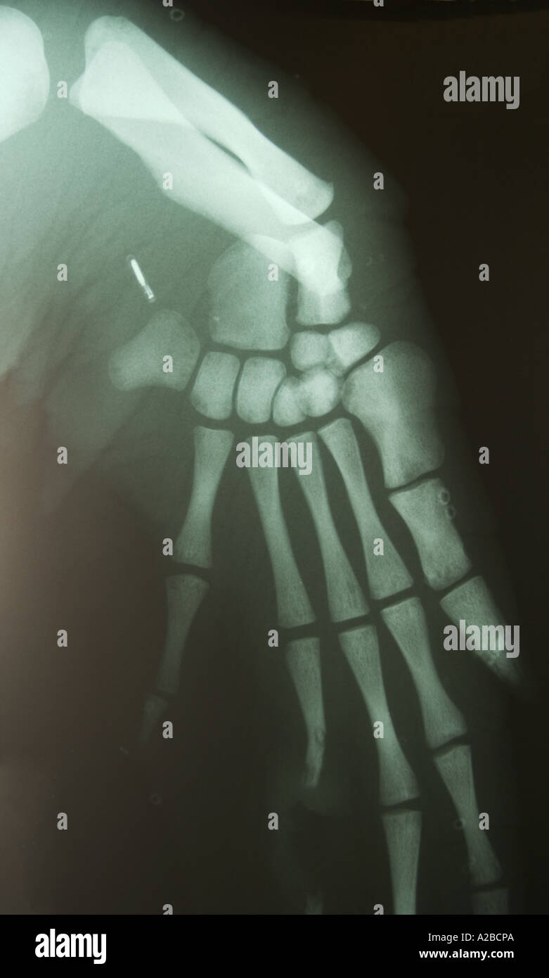 X-Ray of sea turtle flipper showing PIT tag Stock Photo - Alamy