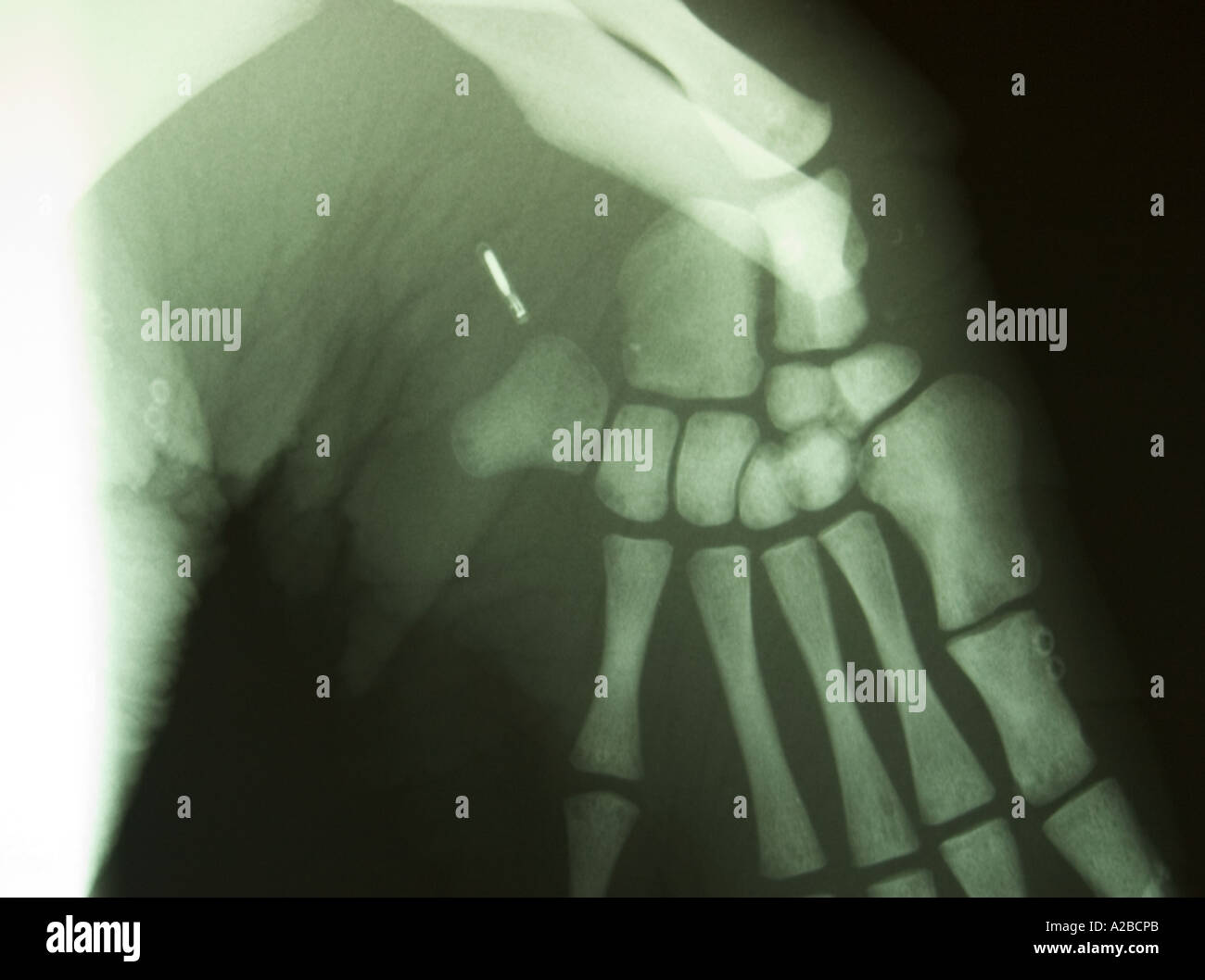 X-Ray of sea turtle flipper showing RFID tag Stock Photo - Alamy