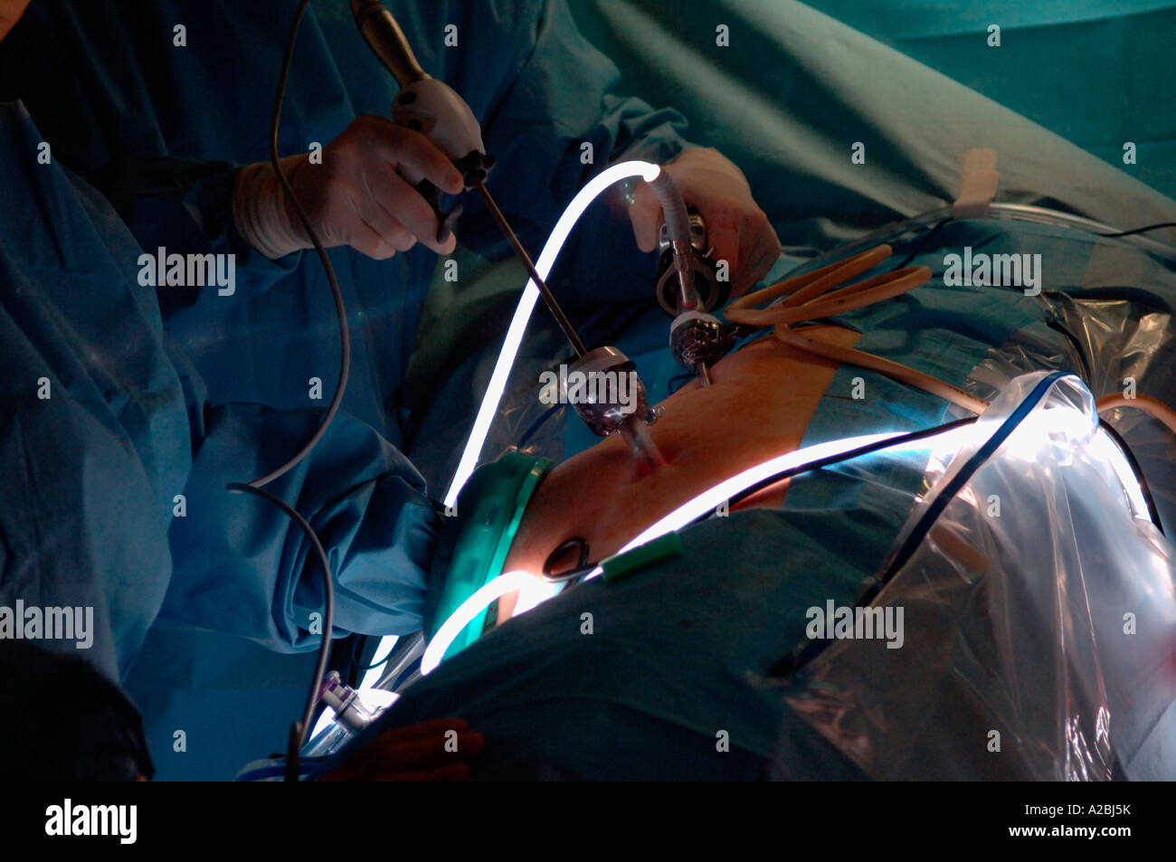 Kidney transplant hi-res stock photography and images - Alamy