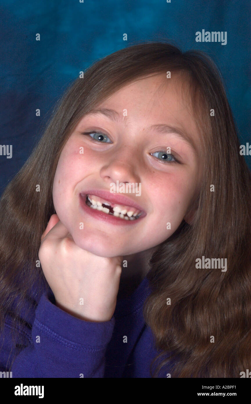 girl with missing front tooth Stock Photo - Alamy