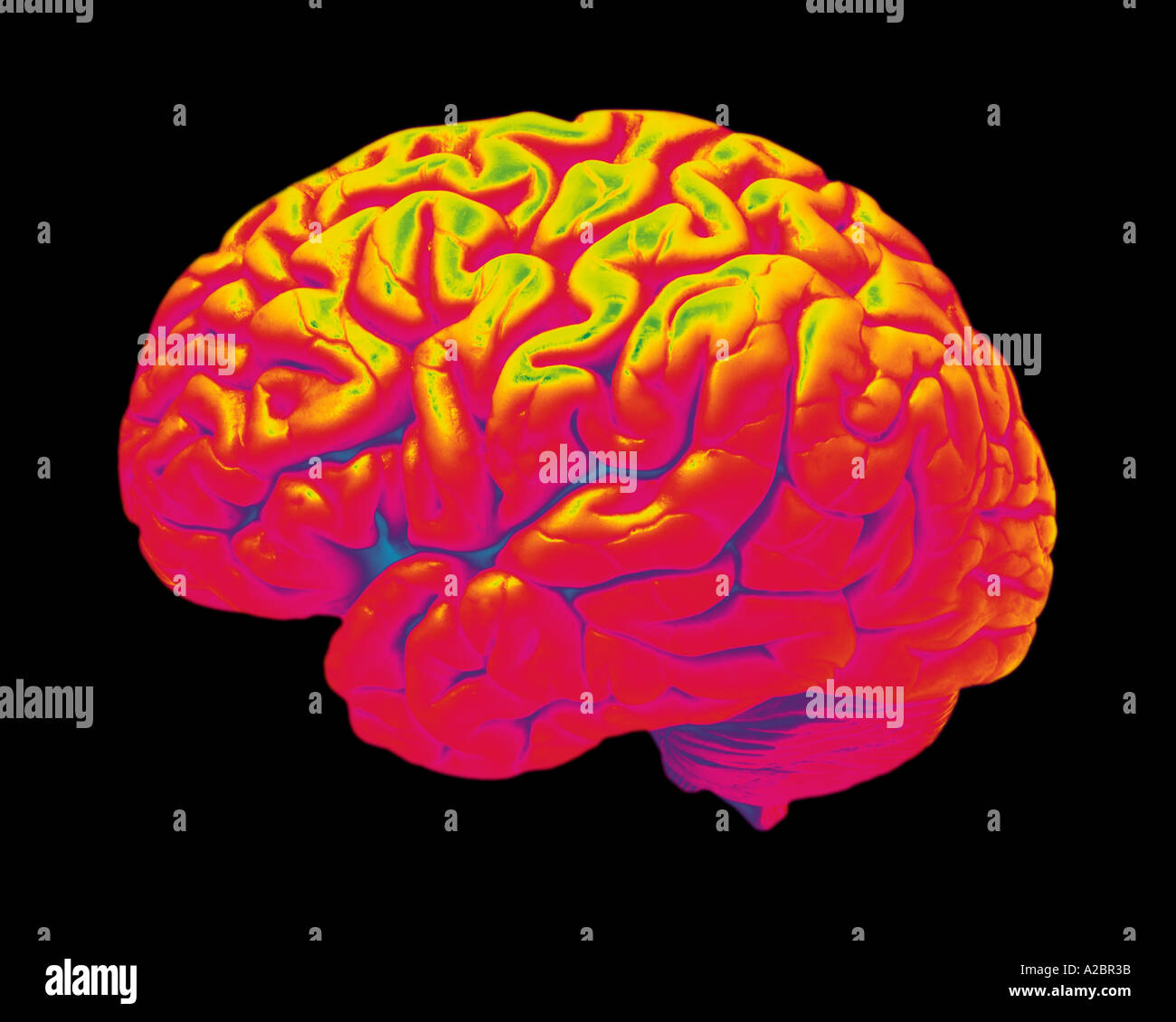 FALSE COLOUR IMAGE OF HUMAN BRAIN ON BLACK BACKGROUND Stock Photo - Alamy