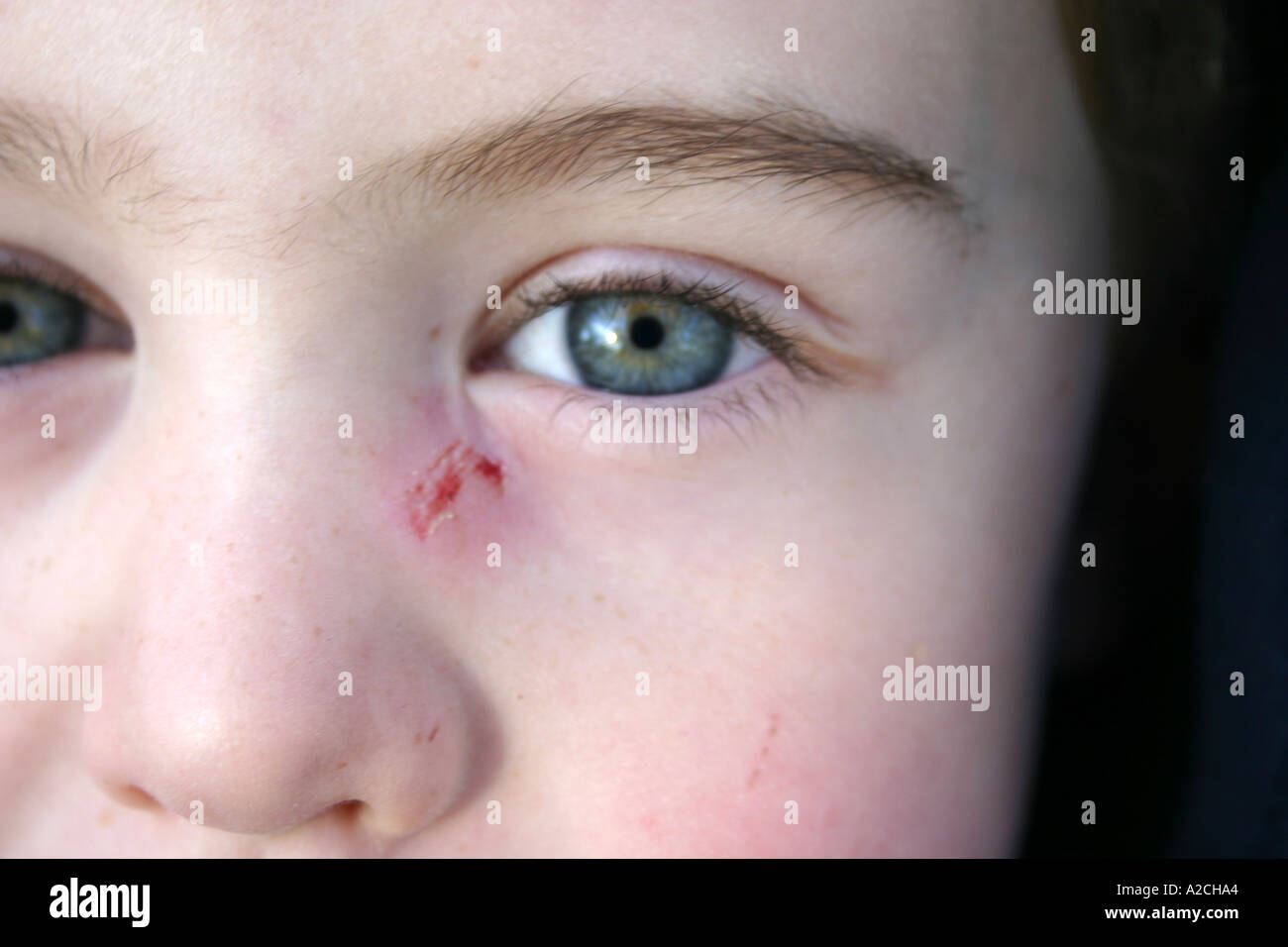 Blood scratch hi-res stock photography and images - Alamy