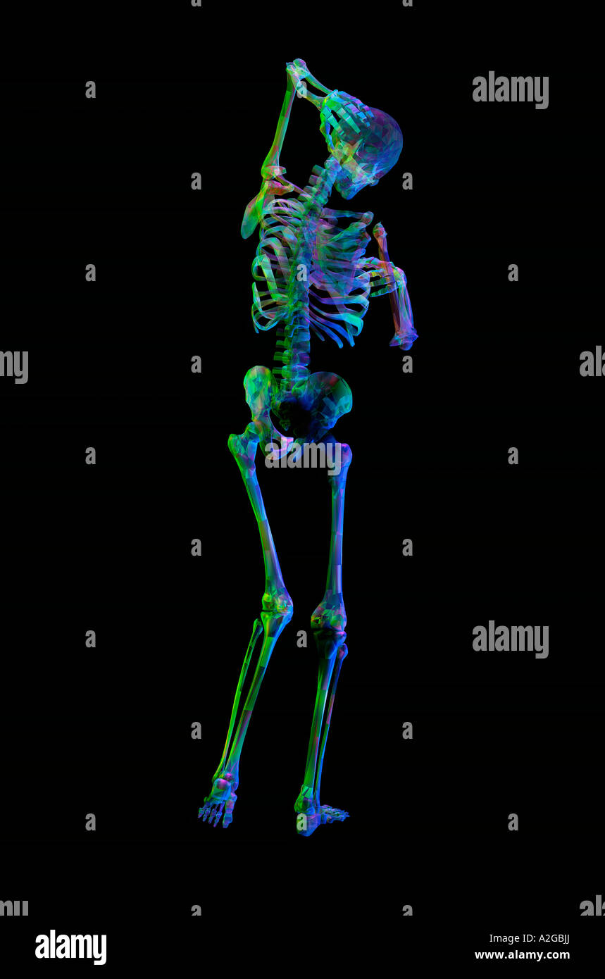 Headache Demonstrated in a Skeleton Stock Photo - Alamy