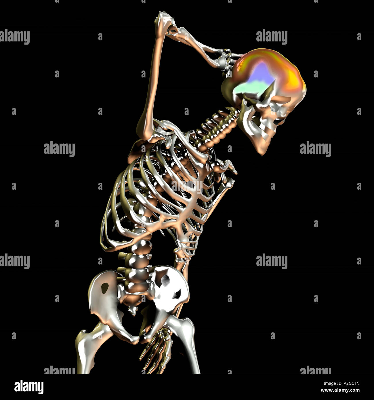 Skeleton with Headache Stock Photo - Alamy