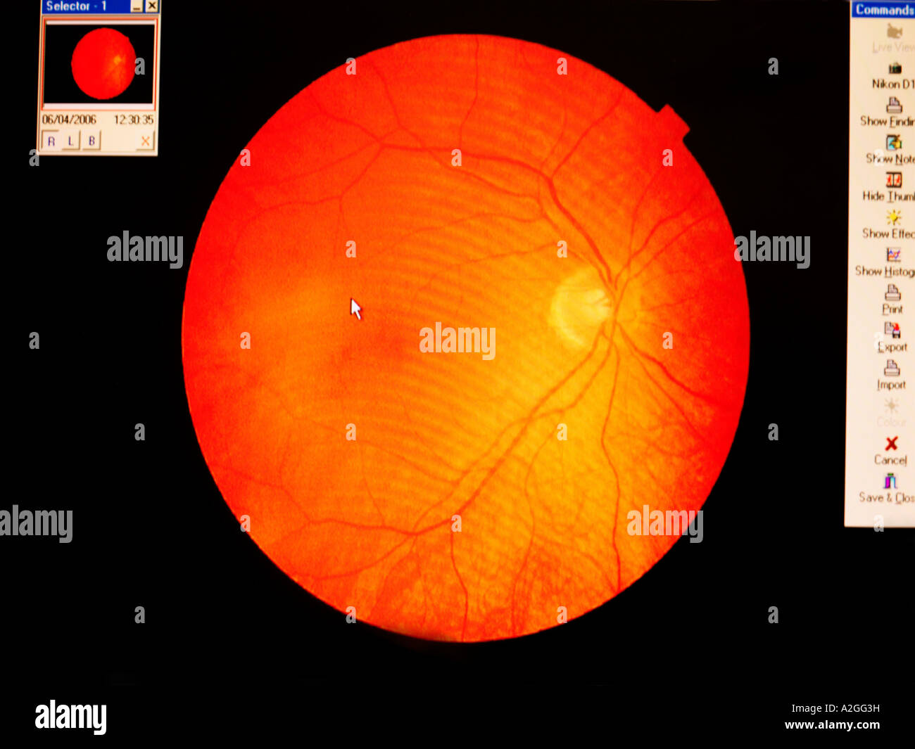 Retina scan hi-res stock photography and images - Alamy