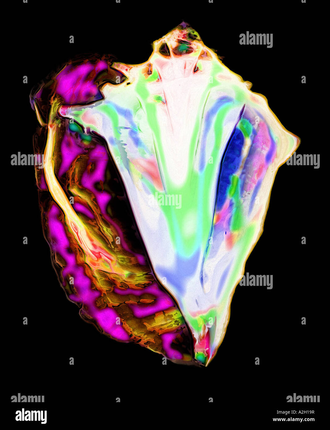 colorized xray of conch shell Stock Photo - Alamy