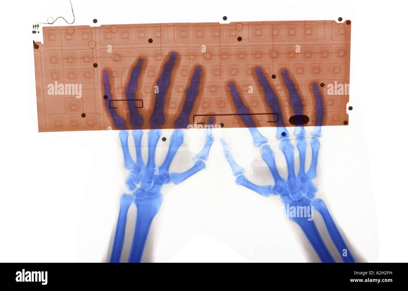 Colorized x ray Cut Out Stock Images & Pictures - Alamy