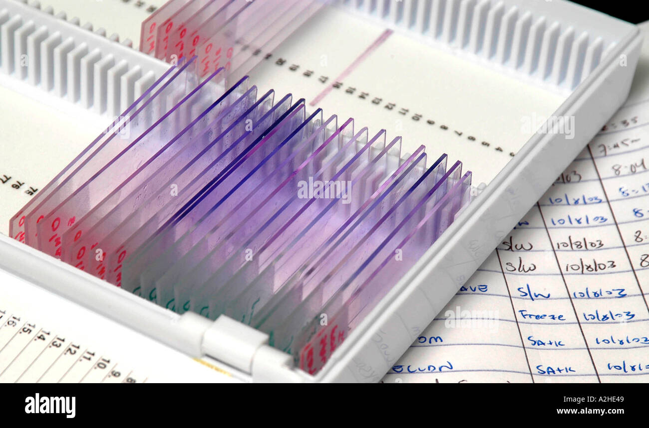 Pathology slides hi-res stock photography and images - Alamy
