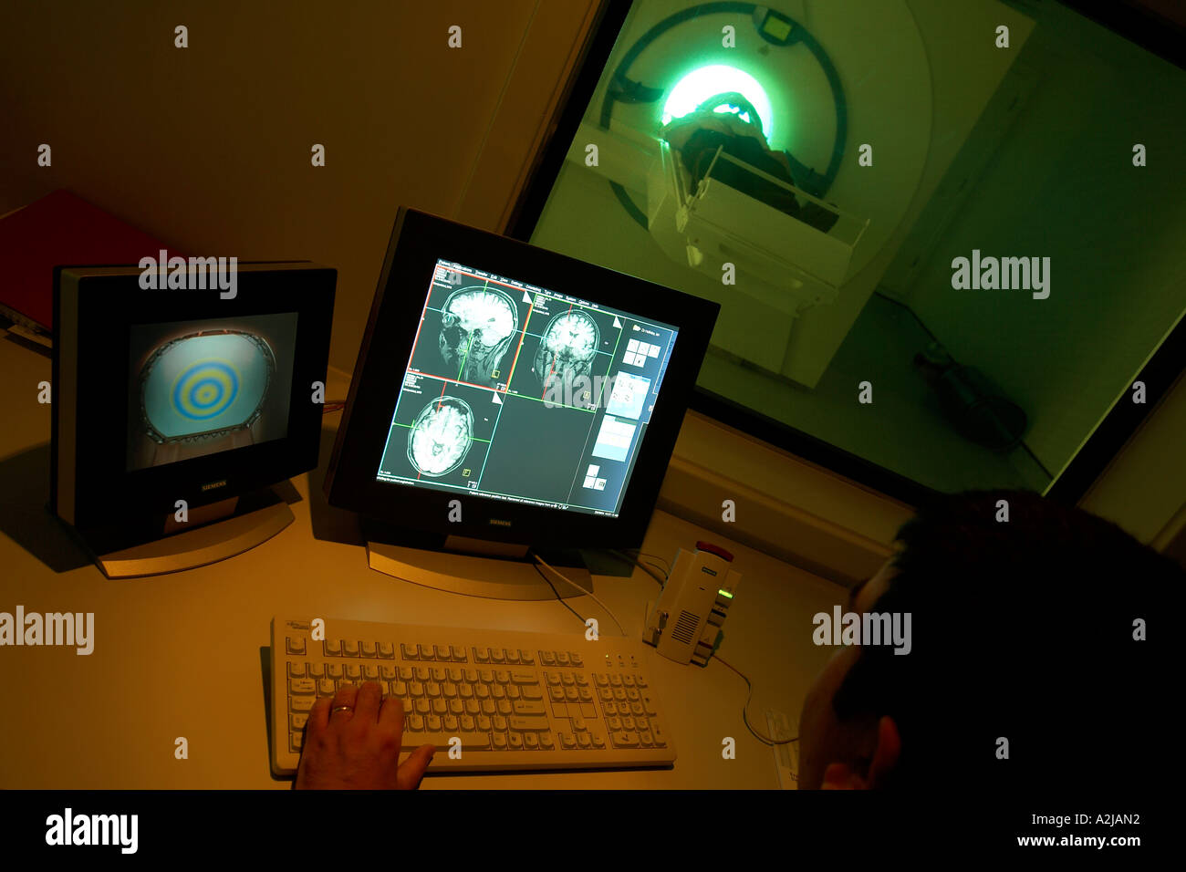 Nhs mri scan brain hi-res stock photography and images - Alamy