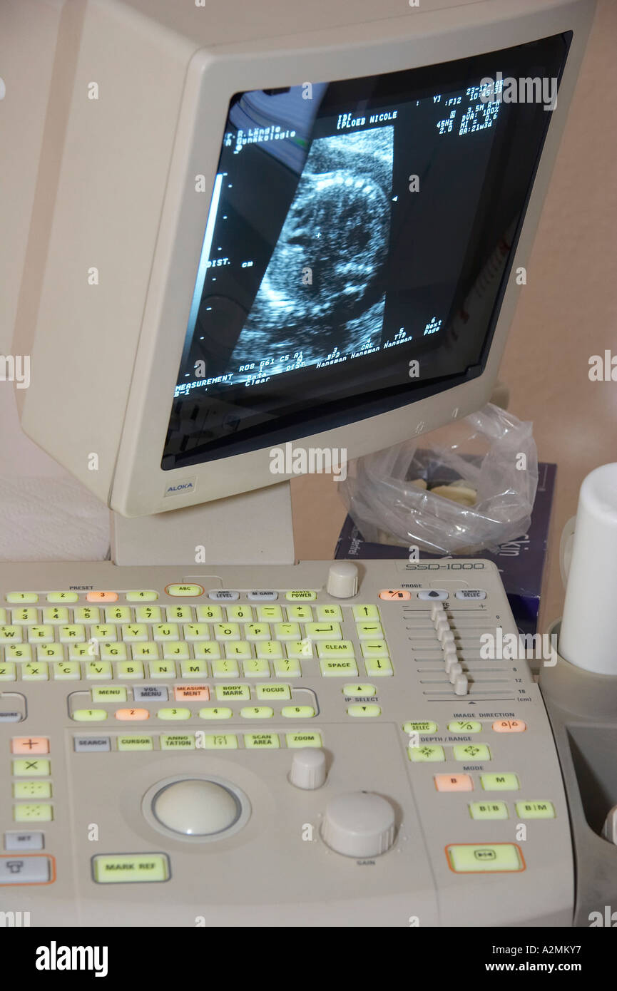 Monitor pregnancy ultrasound ultrasonic examination hi-res stock ...