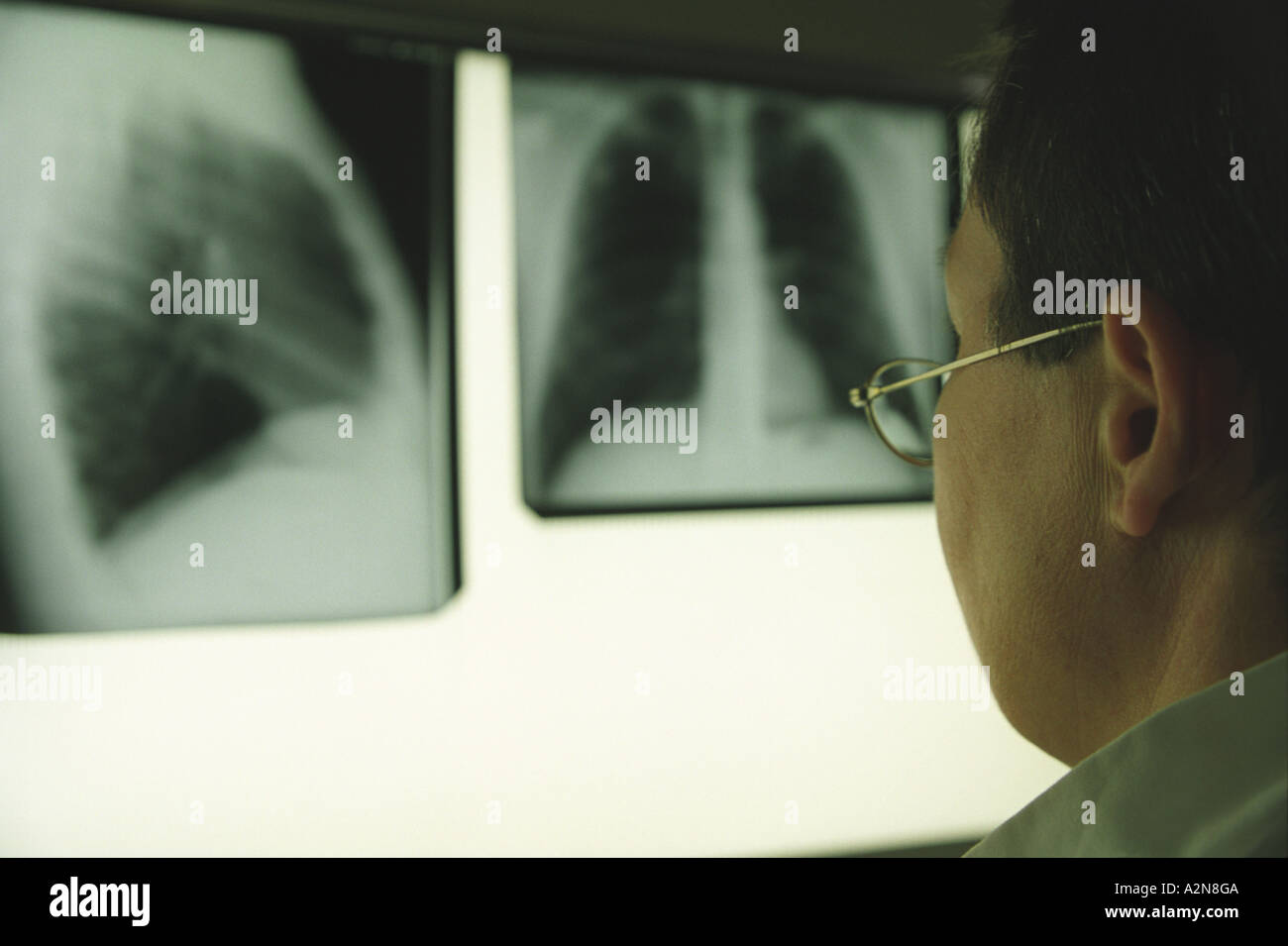 X ray radiography hi-res stock photography and images - Alamy