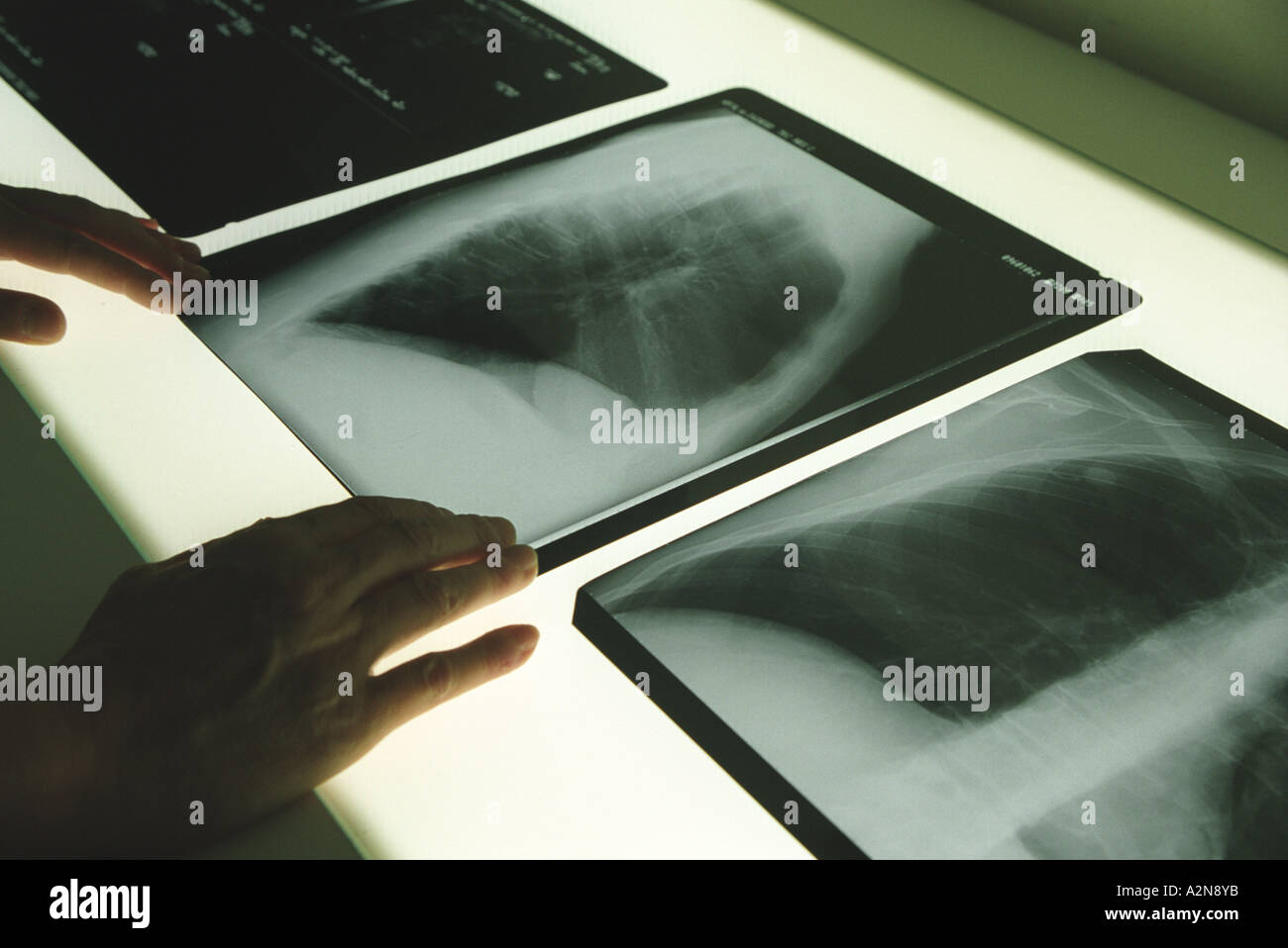 Doctor doing an X-Ray Stock Photo - Alamy