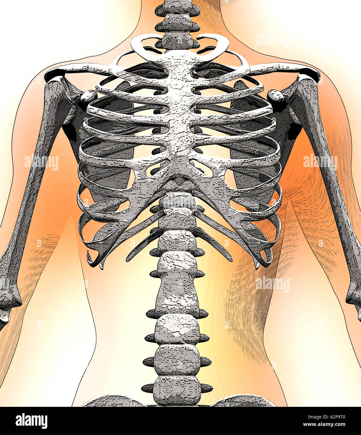 Ribcage xray hi-res stock photography and images - Alamy