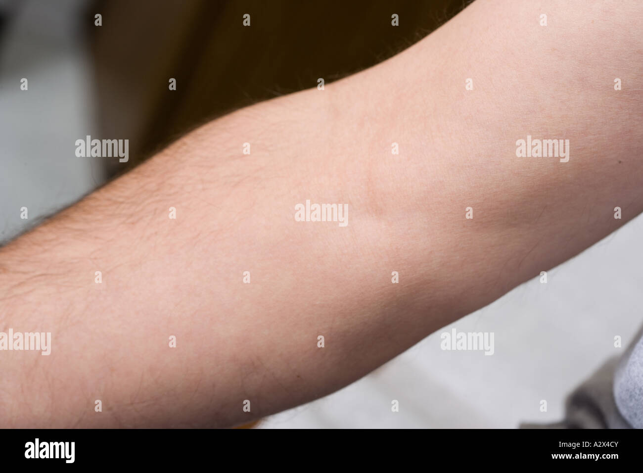 Patient and nurse prepares for a needle to be inserted into arm to draw ...