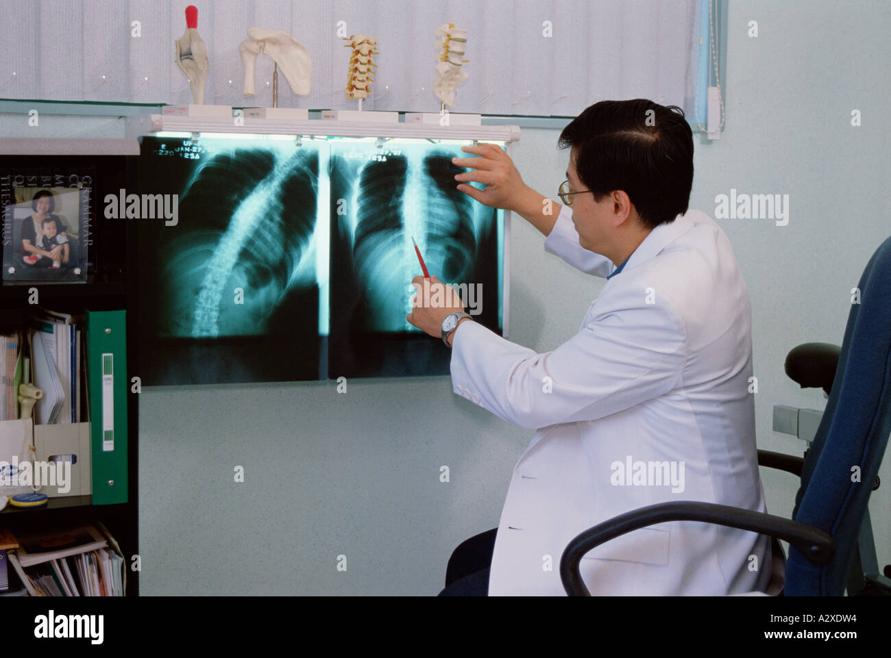 Medical Hospital Radiography. Doctor examining x-ray films Stock Photo ...