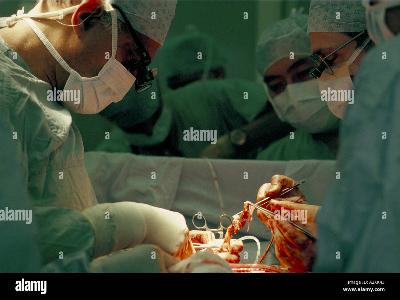 dr magdi yacoub heart surgeon harefield hospital 1993 Stock Photo - Alamy