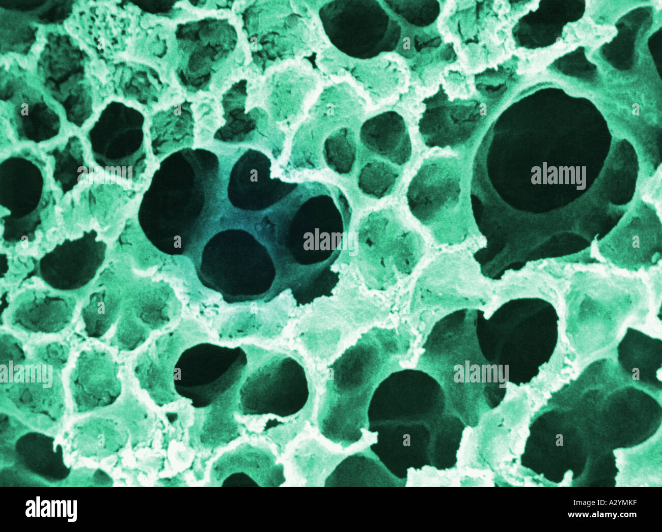 Alveoli micrograph hi-res stock photography and images - Alamy