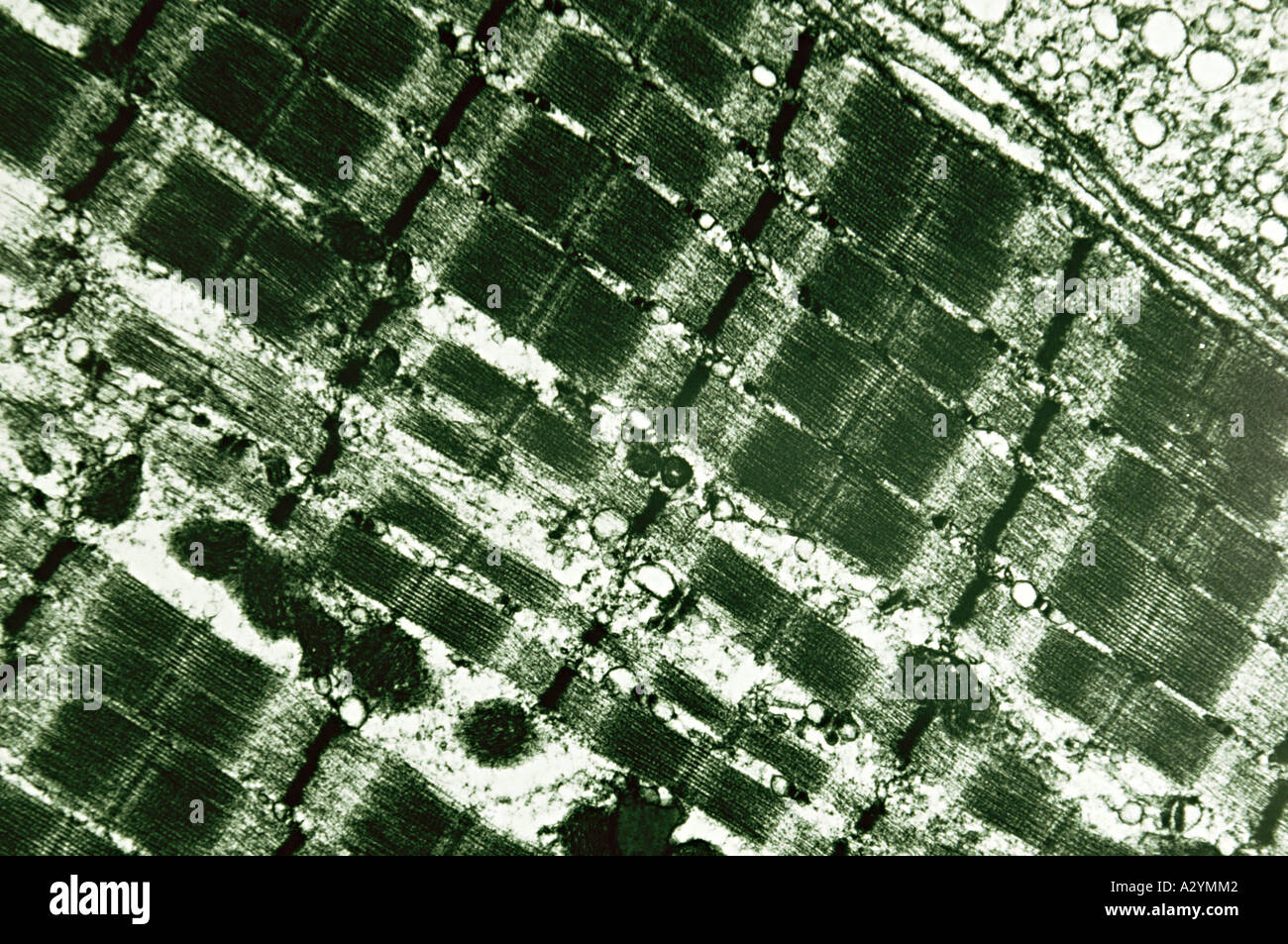 Skeletal muscle micrograph hi-res stock photography and images - Alamy