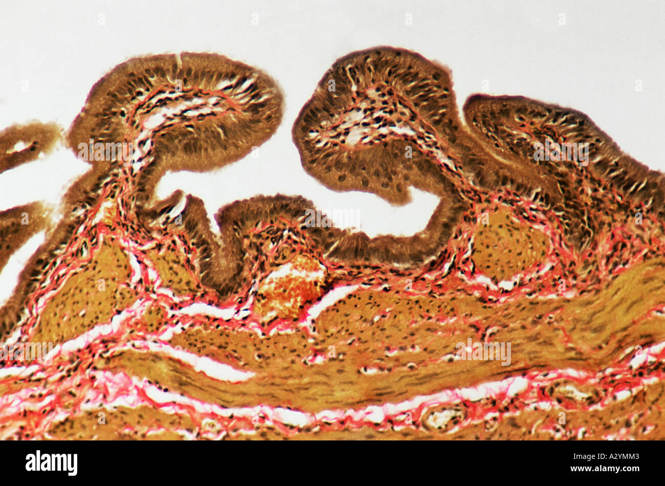 Mucosa in gall bladder Stock Photo - Alamy