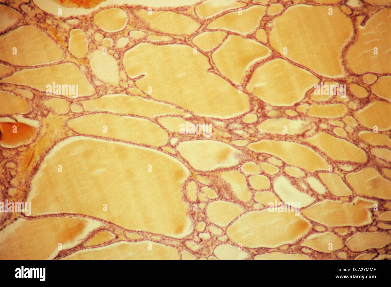 Colloid hi-res stock photography and images - Alamy