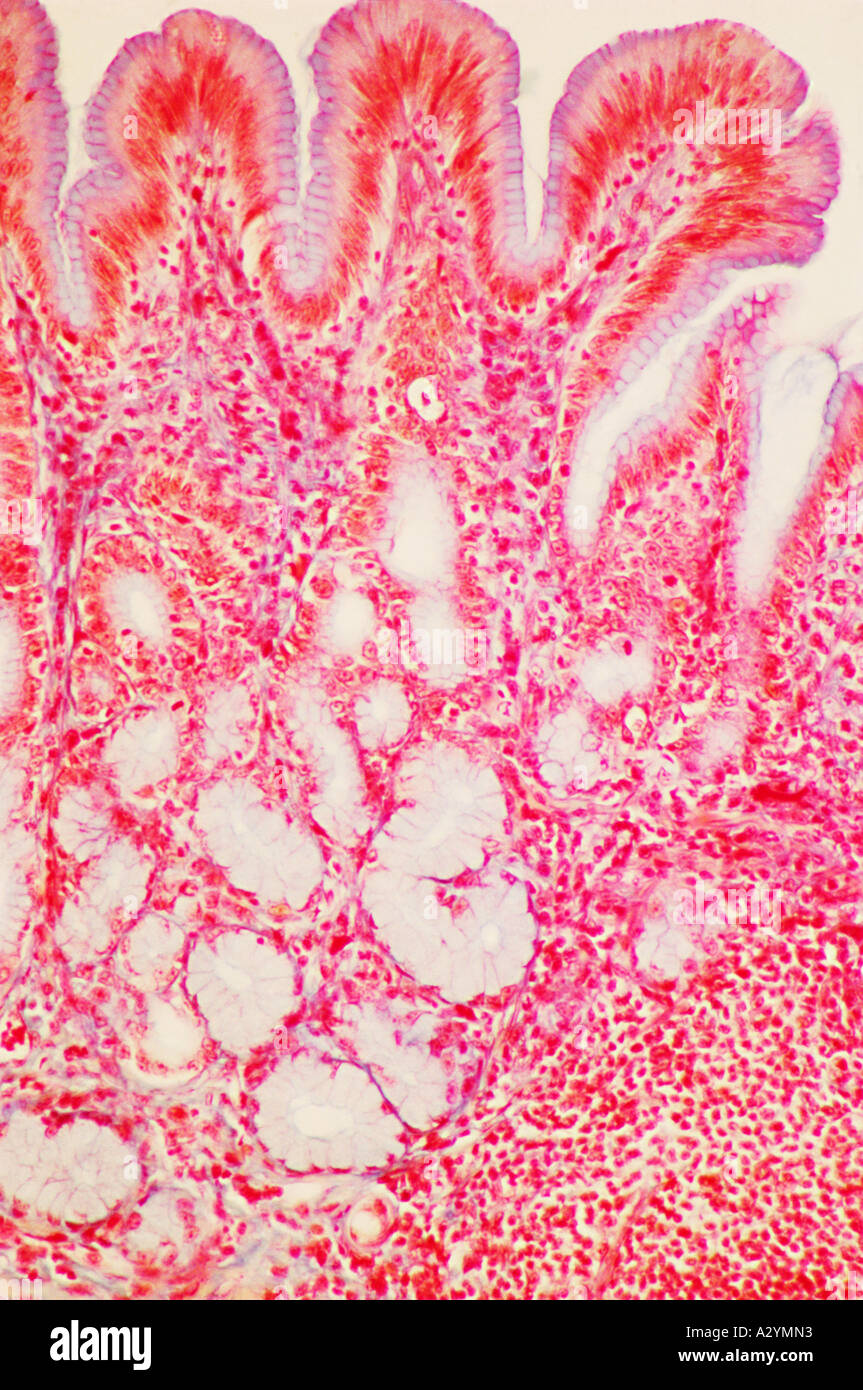 Pyloric hi-res stock photography and images - Alamy