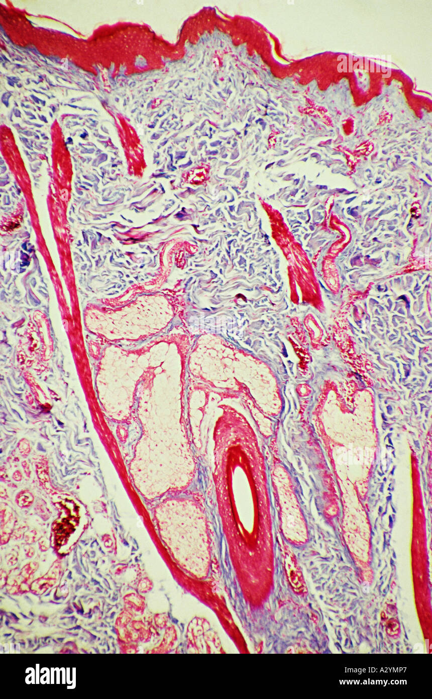 Follicle micrograph hi-res stock photography and images - Alamy