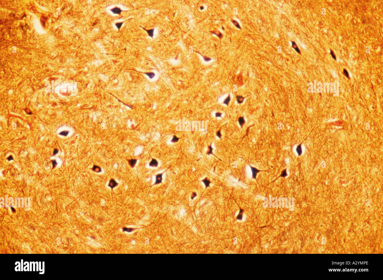 Nerve cell micrograph hi-res stock photography and images - Alamy
