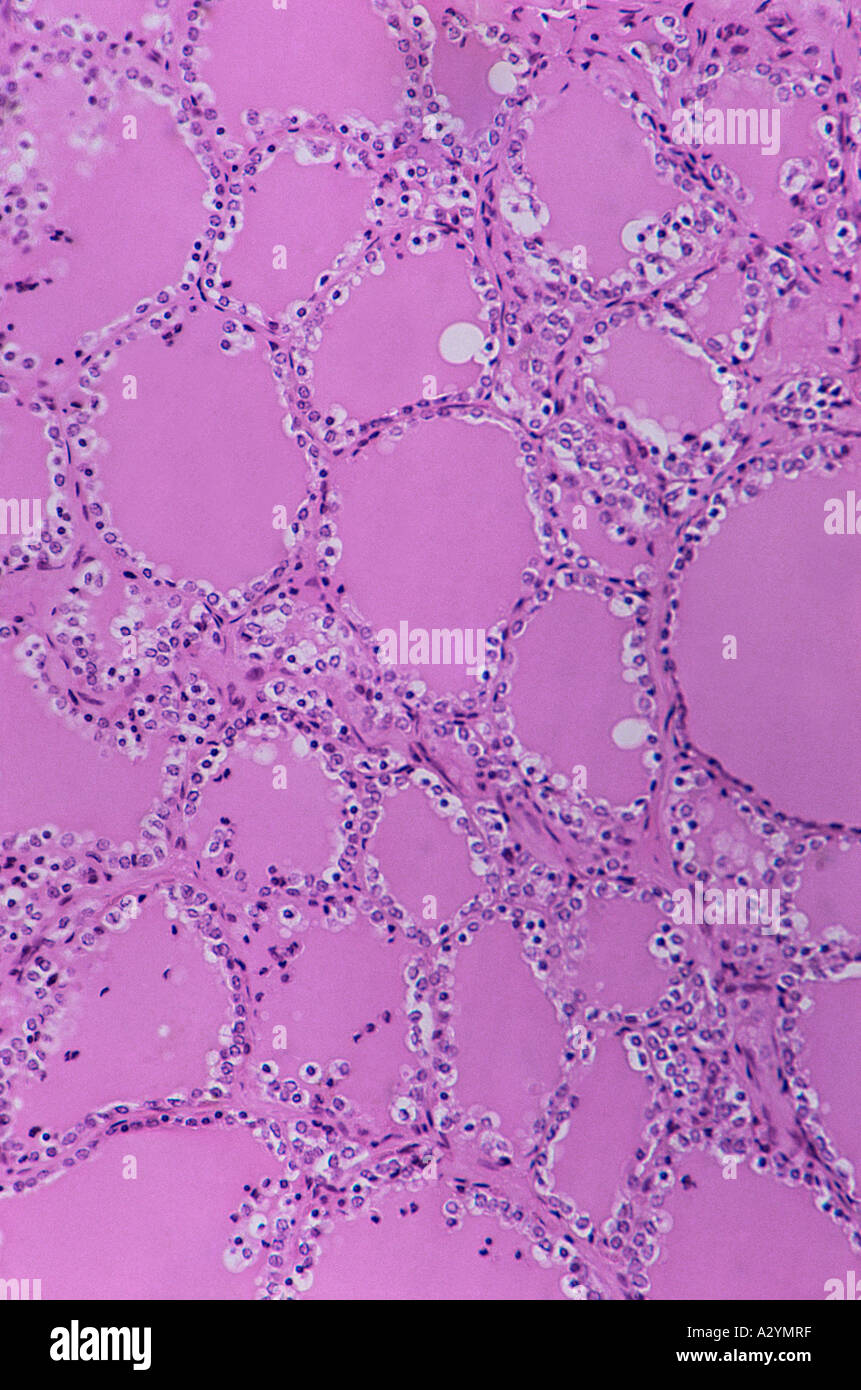 Colloid hi-res stock photography and images - Alamy