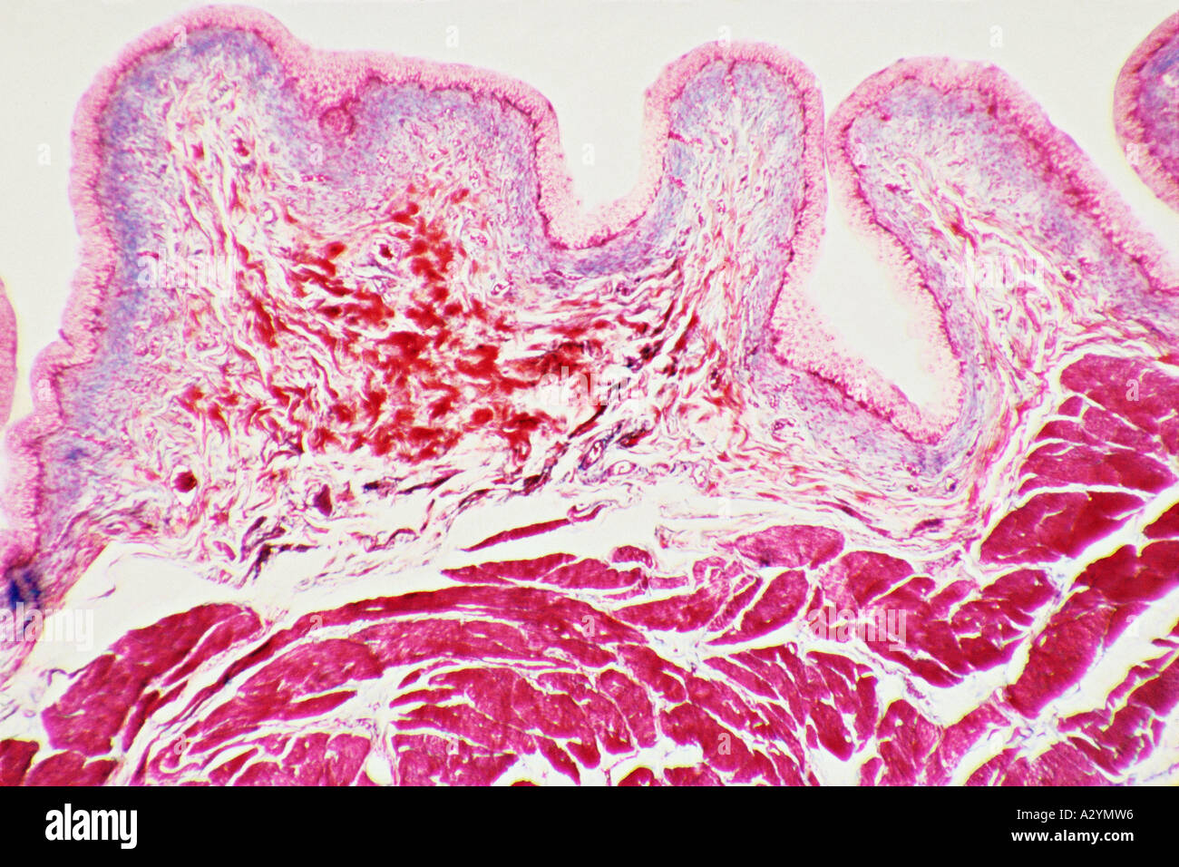 Bladder muscle hi-res stock photography and images - Alamy