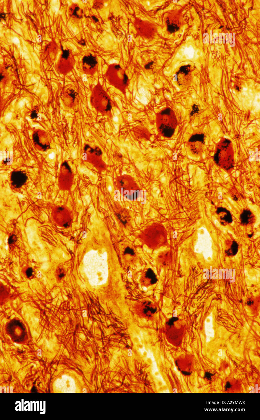 Ganglion cell hi-res stock photography and images - Alamy