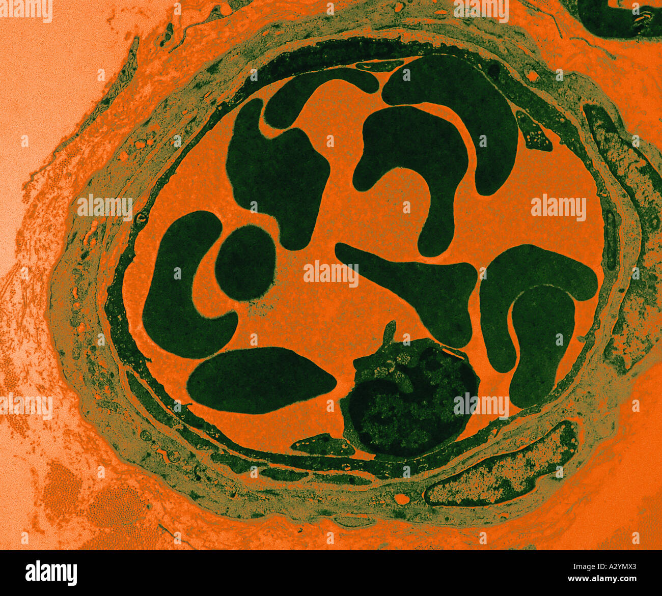 Micrograph of blood vessel hi-res stock photography and images - Alamy