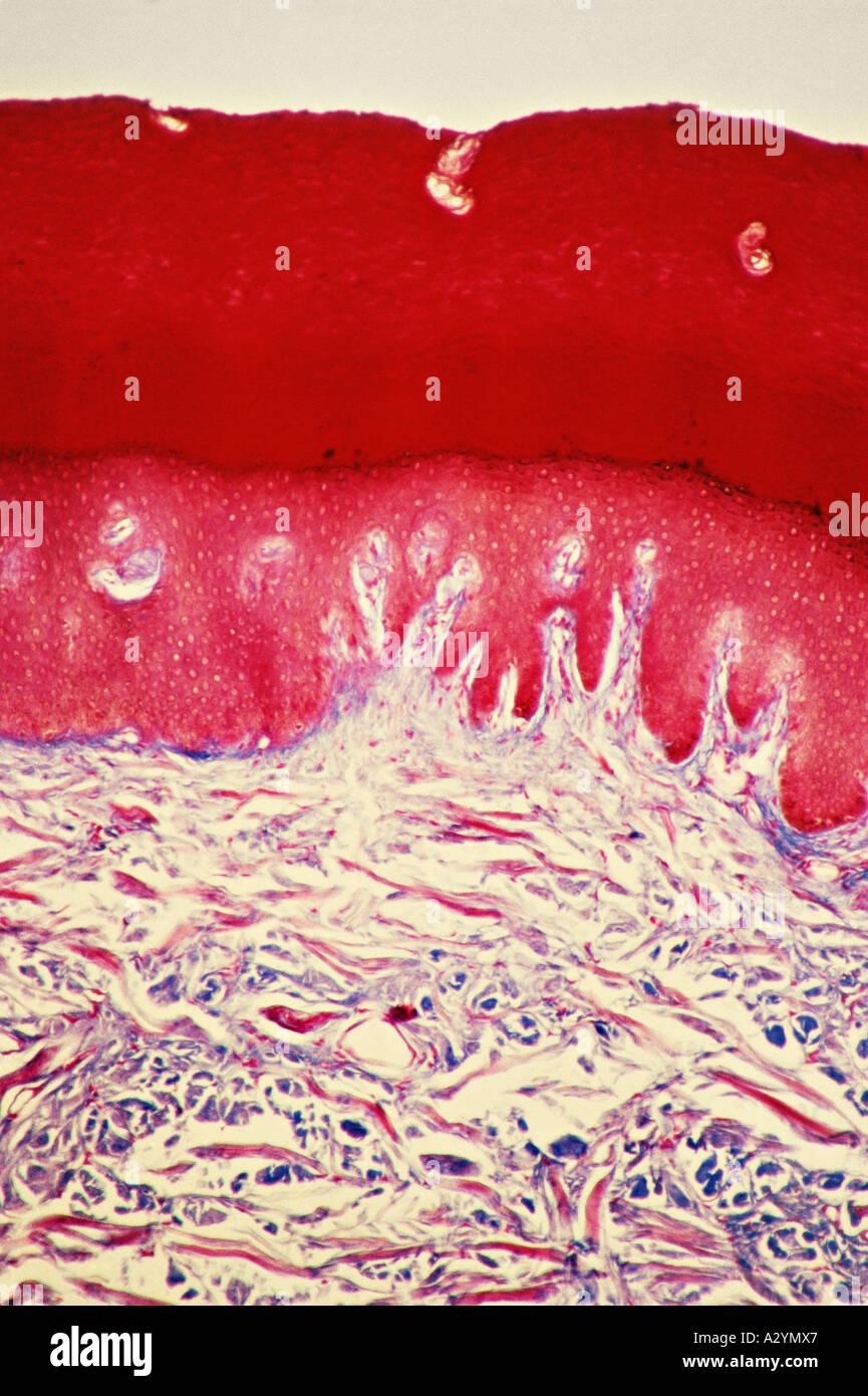 Thick layers of skin Stock Photo - Alamy