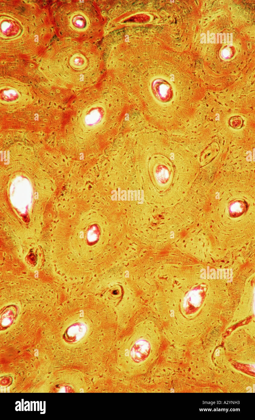 Cavities in bone Stock Photo - Alamy