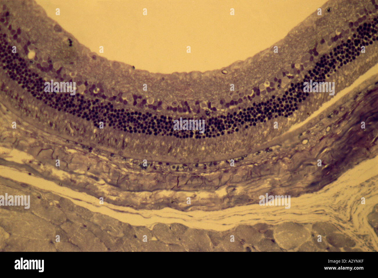 Retina micrograph hi-res stock photography and images - Alamy