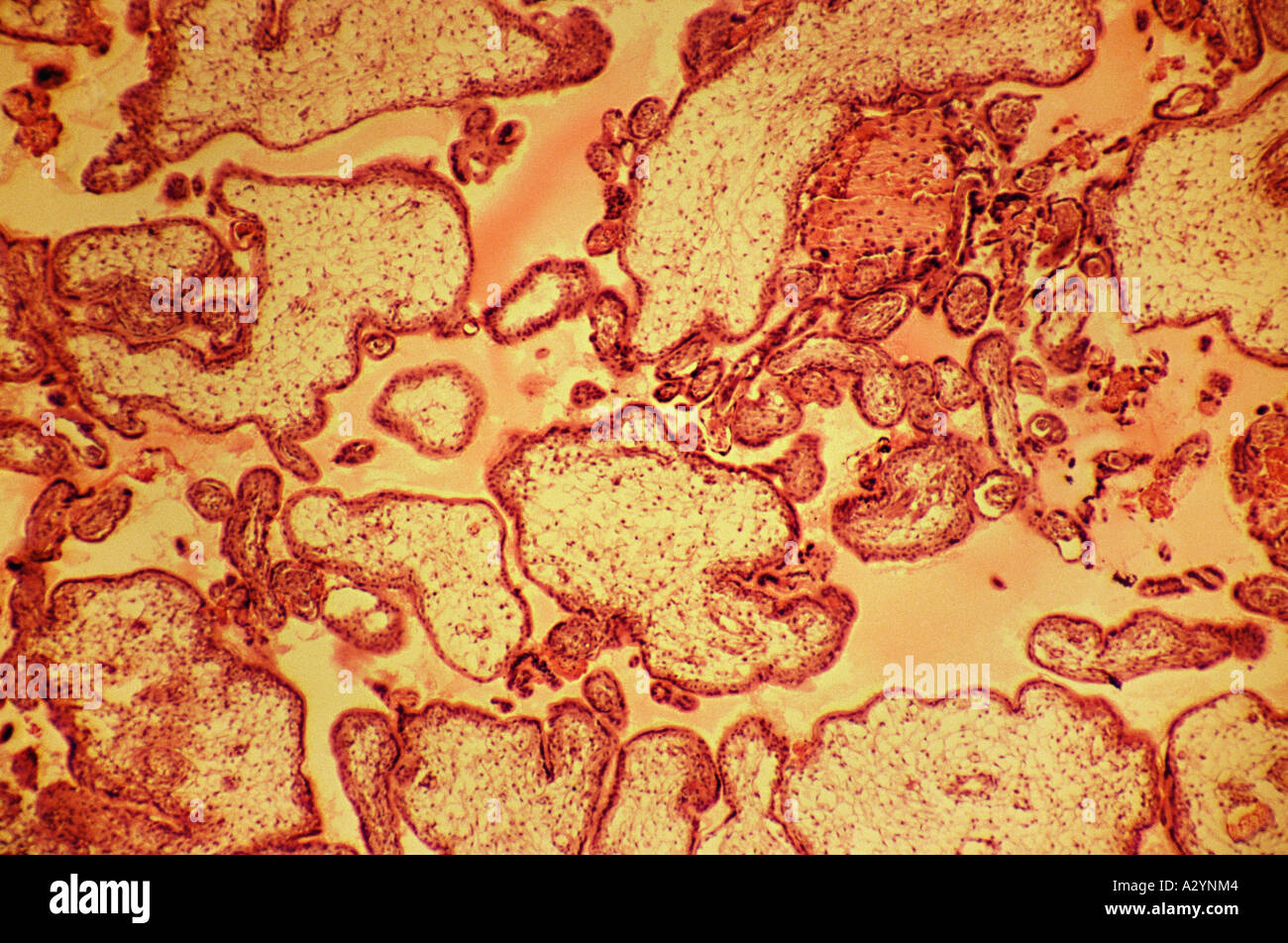 Placenta formation hi-res stock photography and images - Alamy