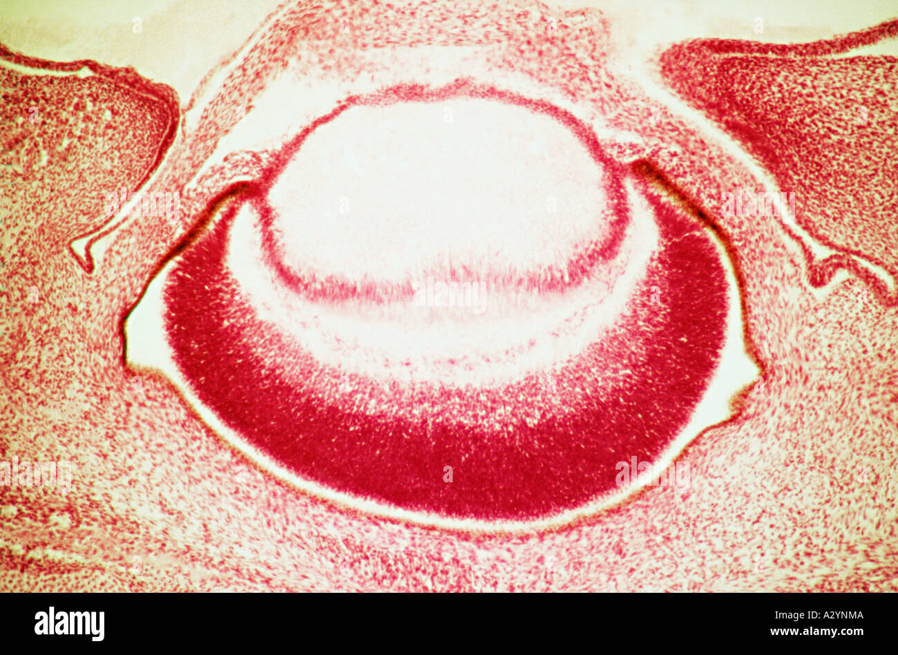 Foetal anatomy hi-res stock photography and images - Alamy
