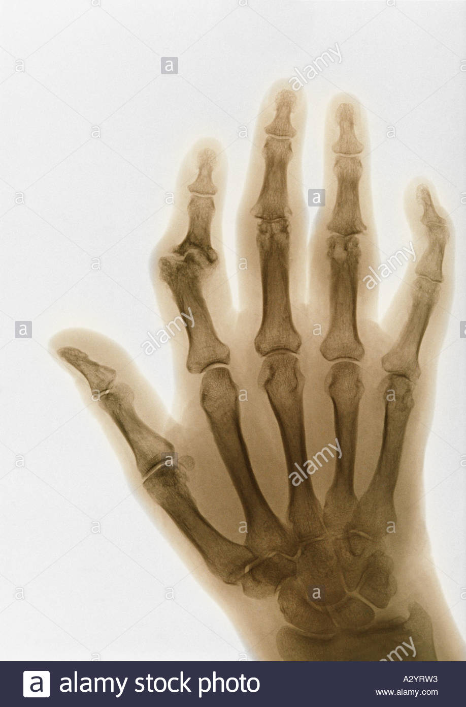 X Rays Of Body Parts Stock Photos & X Rays Of Body Parts Stock Images ...