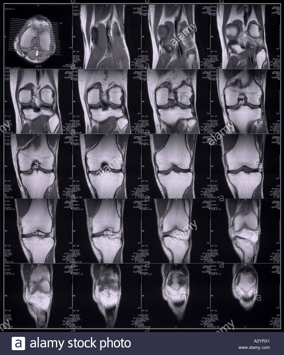 Mri Scan Body Stock Photos & Mri Scan Body Stock Images - Alamy