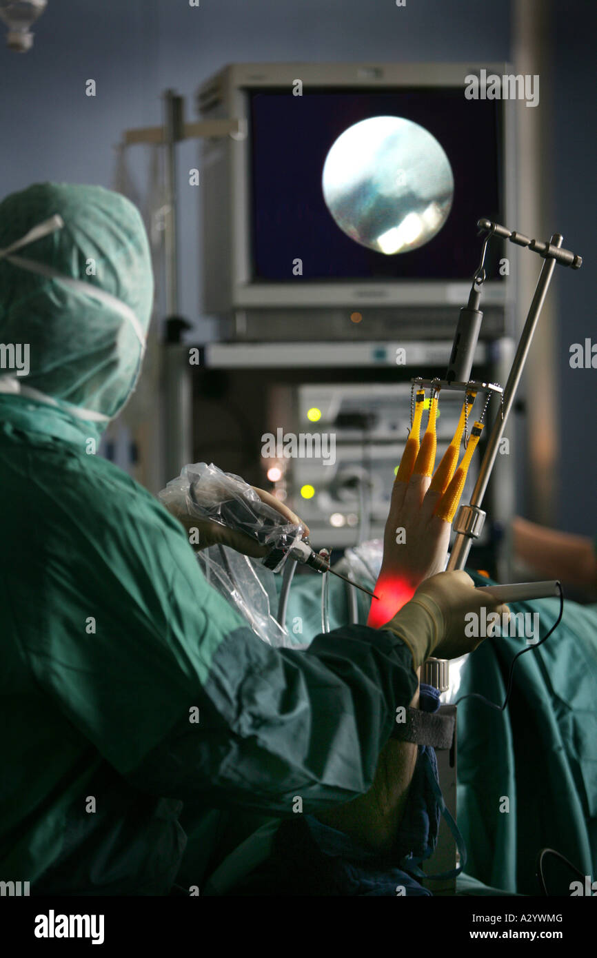 DEU Germany Arthroscopical operation of a wrist Stock Photo - Alamy