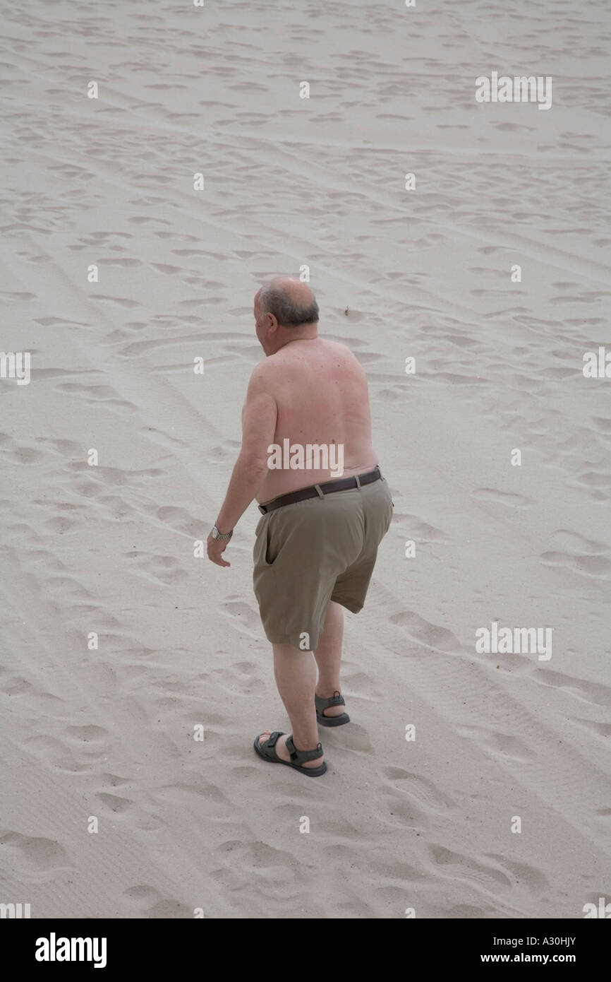 Beach Man Sunburn Senior High Resolution Stock Photography and Images ...