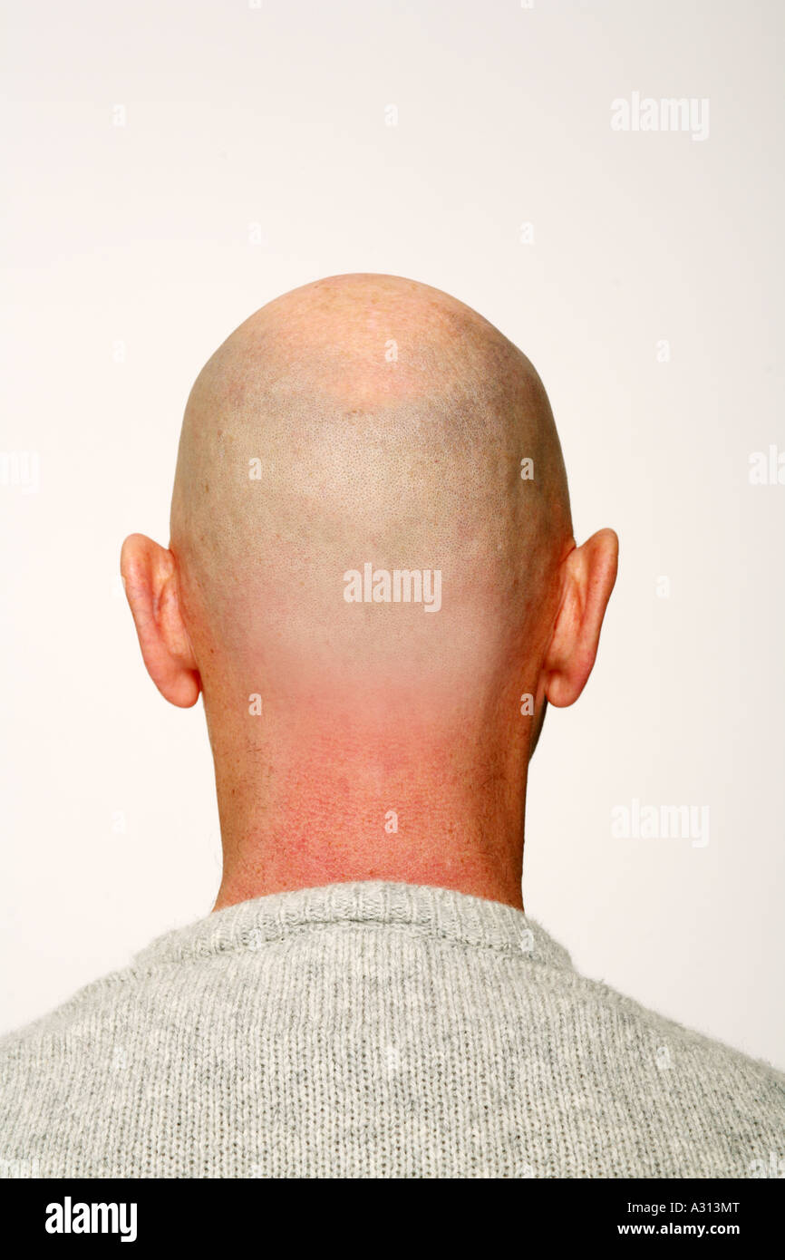Bald shiny head hi-res stock photography and images - Alamy