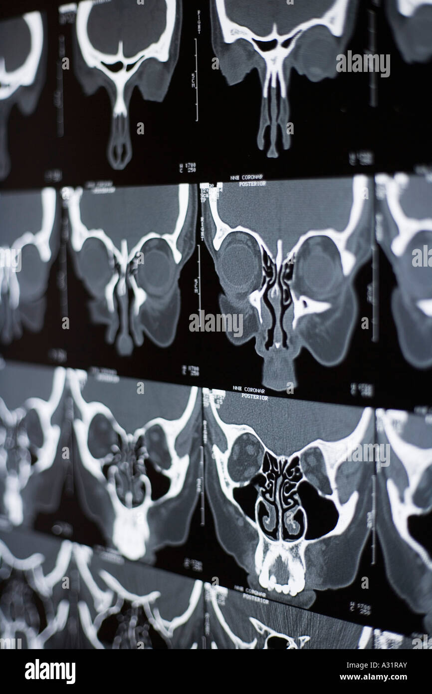 Cat brain anatomy hi-res stock photography and images - Alamy