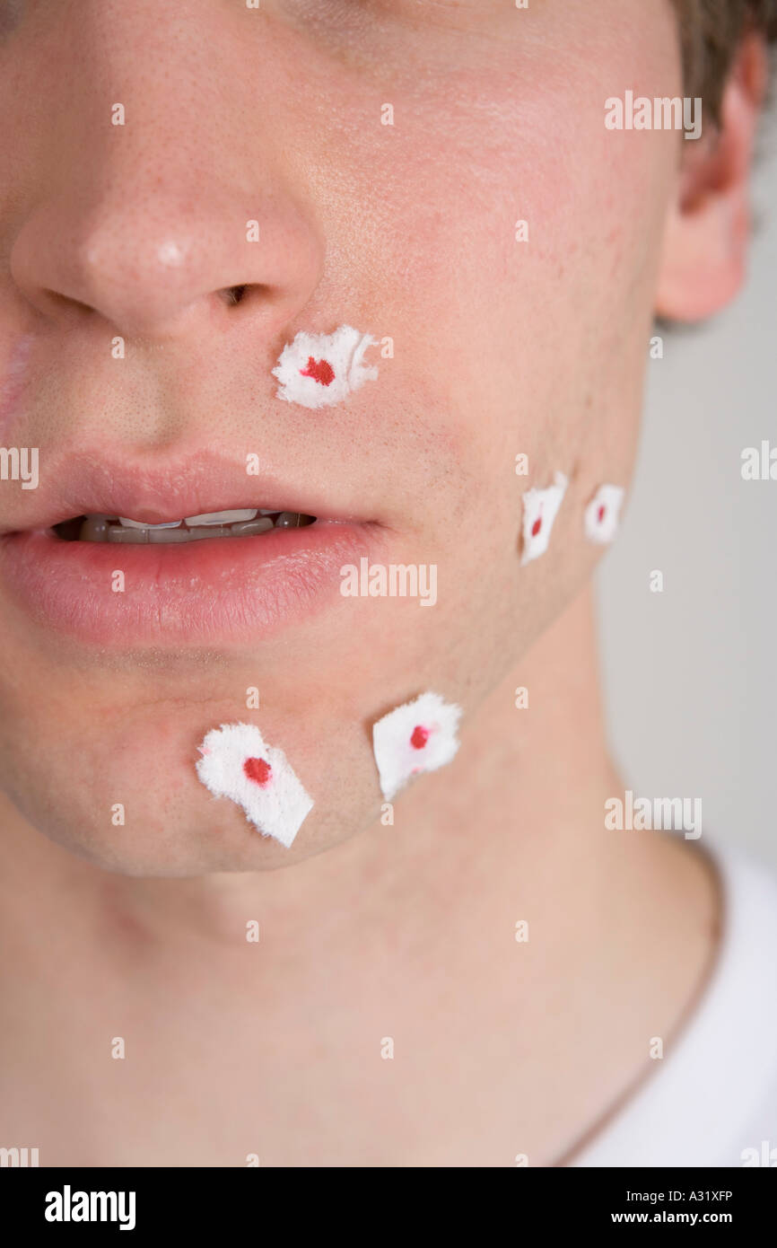 Shaving wounds hi-res stock photography and images - Alamy