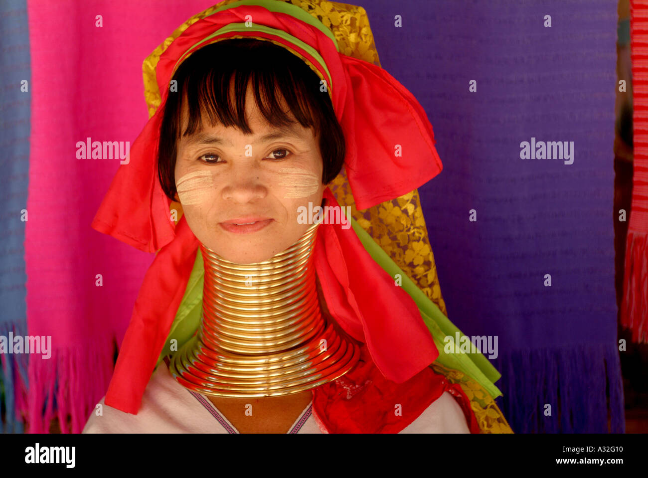 Deformed neck hi-res stock photography and images - Alamy